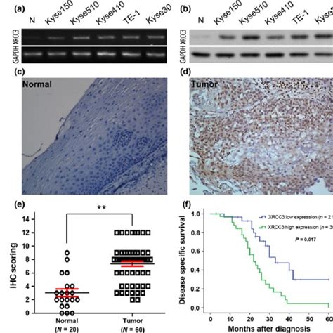Xrcc3 Expression In Esophageal Squamous Cell Carcinoma Escc Cell