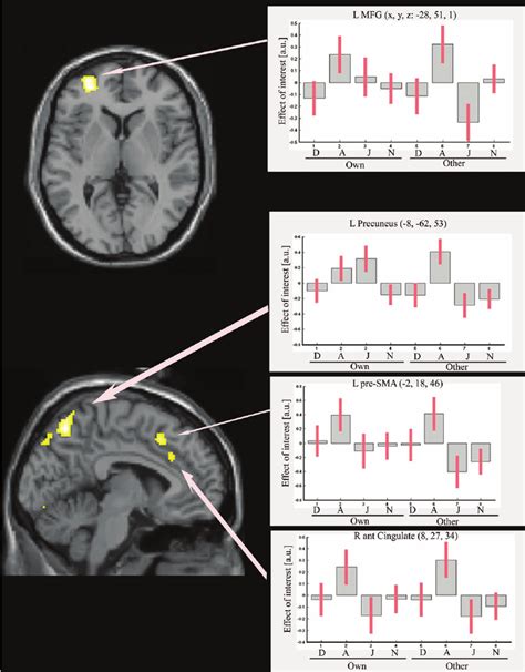 Ambiguous Expression Observation Ambiguous Stimuli Areas With