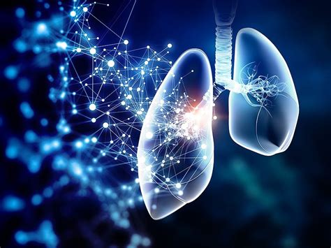 Fda Clears Nines Ai Based Lung Nodule Measurement Tool 2021 03 30