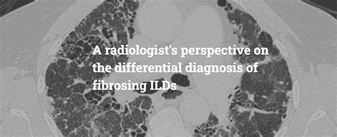 Hrct E Learning Boehringer Ingelheim Danmark