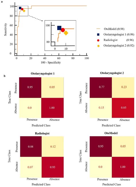 Figure 1 From Automated Detection Of Otosclerosis With Interpretable Deep Learning Using