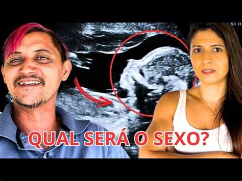 Dia De Ultrassom Pra Saber O Sexo Do Beb Youtube