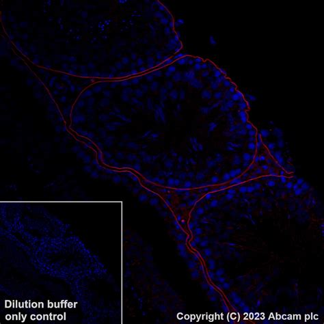 Alexa Fluor® 555 Anti Lama1 抗体 Epr27258 37 Ab314883