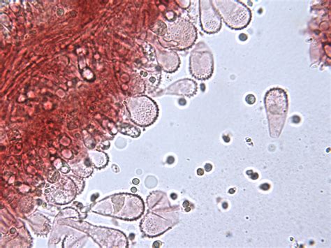 Agaricus Gill Microscope