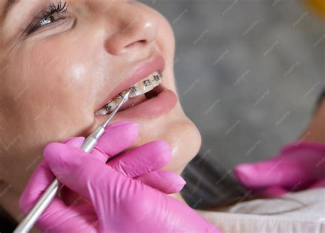 Premium Photo Dental Procedure For Installing Braces Close Upthe