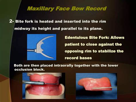 4 C Face Bow Record Ppt