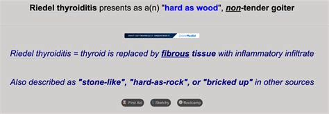 Never Going To Forget Riedel Thyroiditis Rmedicalschoolanki