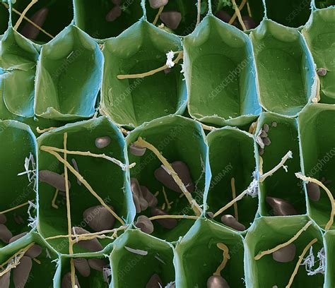 Panama Disease Pathogen In Banana Leaf Sem Stock Image C049 1656 Science Photo Library
