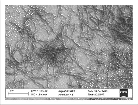 Scanning Electron Microscopic Image Of An Insulin Fibril Network Download Scientific Diagram