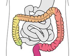Guzy Nosa I Zatok Przynosowych Przyczyny Objawy Leczenie