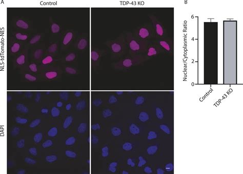 Pleiotropic Requirements For Human Tdp In The Regulation Of Cell And Organelle Homeostasis