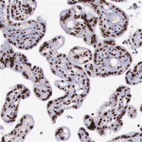Rabbit Polyclonal Anti Yy1 Antibody Buy For Research Highly Specific Rigorously Validated