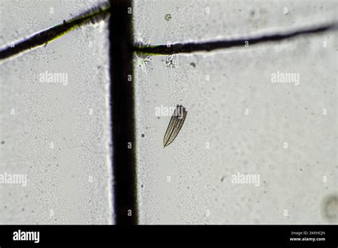 Dragonfly Wing Under A Microscope Looking At Microscopic Details In A Bug Wing In Australia