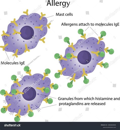 Allergy Response Immune System Allergens Attach Stock Vector Royalty