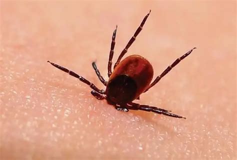 Typhus Diagnostic Methods Causative Agent Symptoms Therapy And Prevention Health