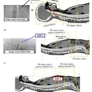 Illustration Of Gaps Used To Verify Field Junctions Gap Represents Download Scientific