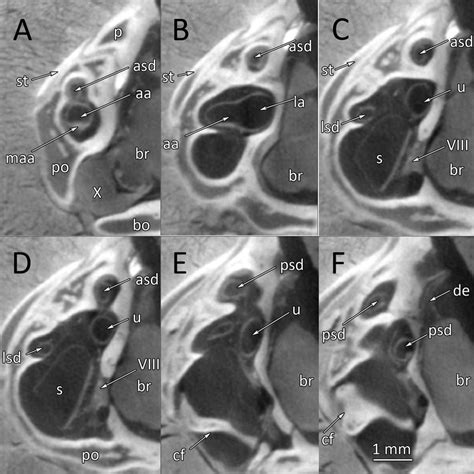 Python Regius Serial μct Images From Rostral To Occipital Through The