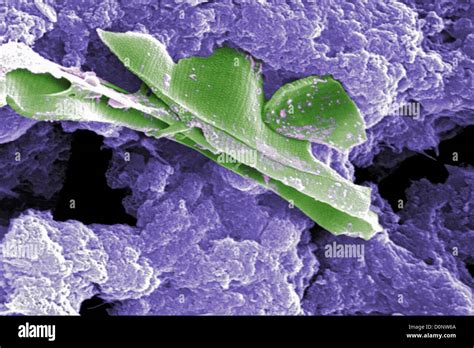 This Digitally Colorized Scanning Electron Micrograph SEM Untreated