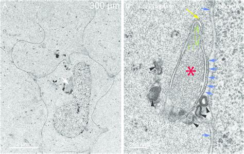 Indentations Often Reveal A Large Macromolecular Complex Adherent To Download Scientific