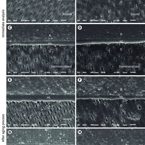 Photomicrographs ×1000 Of The Adhesive Interface Immediately After