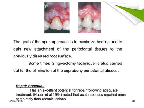 Periodontal Abscess Etiology Pathogenesis Ppt