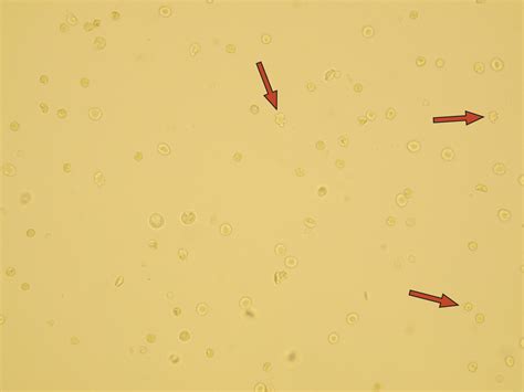 Microscopic Analysis Of Urine Faculty Of Medicine Masaryk University