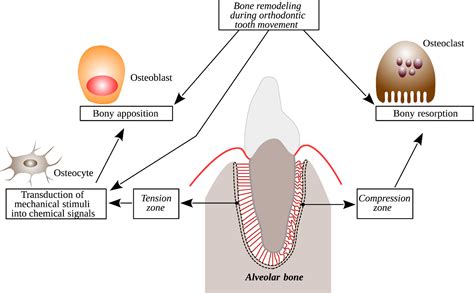 Bone Remodeling During Orthodontic Tooth Movement Bone Formation And