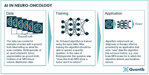 Artificial Intelligence In Neurology Promising Research And Proven Applications