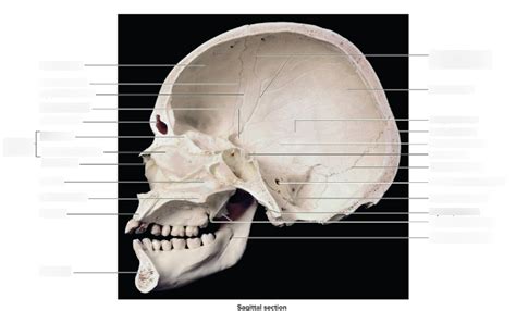 Axial Skeleton Cranial And Facial Bones Sagittal Diagram Quizlet