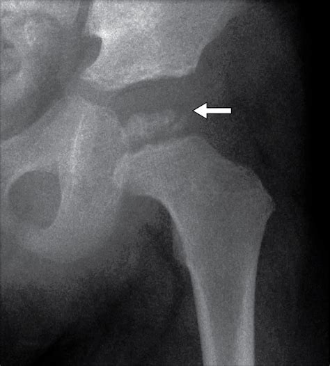 Picture Of The Month—diagnosis Endocrinology Jama Pediatrics Jama
