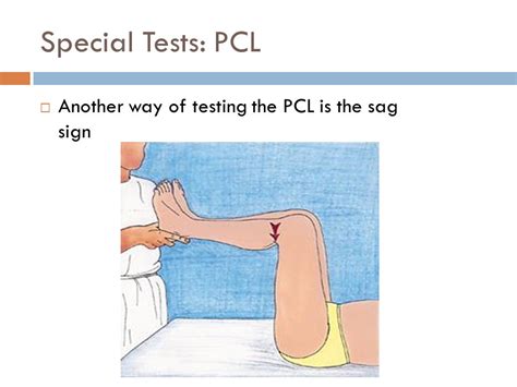 The Examination Of The Knee Echo Sports Medicine 47 Ppt Video Online Download The Examination Of The Knee Echo Sports Medicine 47 Ppt Video Online Download