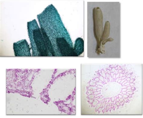 Invertebrates Flashcards Quizlet