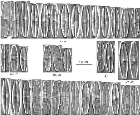 Achnanthidium Druartii Species Diatoms Of North America