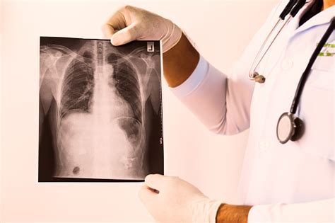 Dokter Memeriksa Radiografi Paruparu Dokter Melihat Film Rontgen Dada