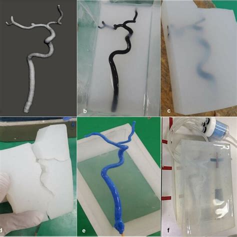 Cerebral Arterial Silicone Phantom Casp Used To Replicate Real Download Scientific Diagram