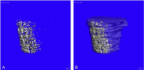 Figure 72 From Use Of Osmium Tetroxide Staining With Microcomputerized
