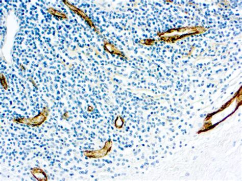 Factor Viii R Antigen Diagnostic Biosystems Advanced Tissue