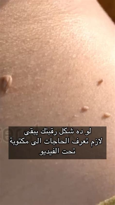 Mayar Mohamed The Health Coach ‎فراخ بالخضار ولا اسهل 👌 مكعبات صدور