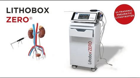 Pneumatic And Ultrasonic Lithotripters Lithobox Zero Ultrasonic