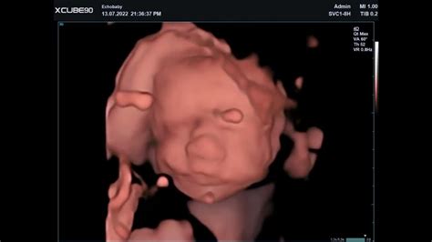 3d Pretecho 26 Weken Youtube