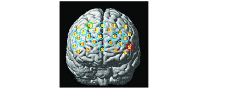The Results Of Nodal Efficiency And Complexity The Number On The