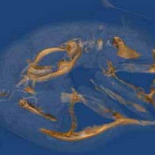 A CT Dataset Visualized By Volume Rendering Download Scientific Diagram