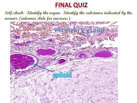 Ppt Pituitary Gland Digital Laboratory Powerpoint Presentation Free