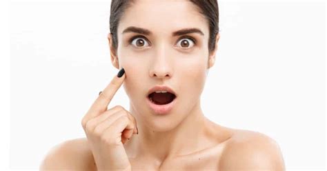 Get Rid Of Acne