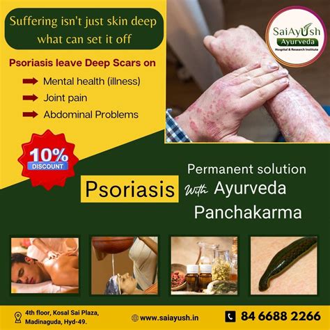 Top Ayurvedic Hospital In Hyderabad Sai Ayush By Saiayushayurveda On