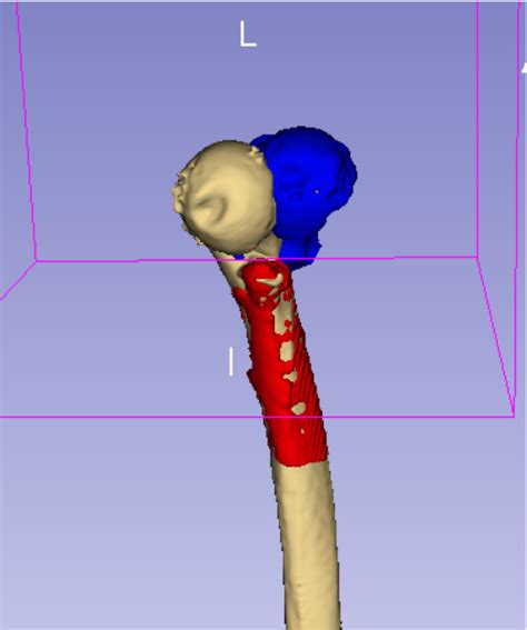 Model Registration From Fiducial Point Support 3d Slicer Community