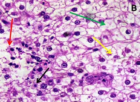 Hepatocyte Histology