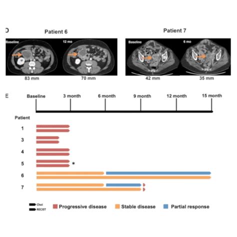 Ilixadencel Een Veelbelovende Behandeling Voor Gist