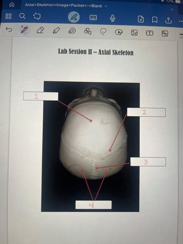 Axial Skeleton Lab Human Anatomy Flashcards Quizlet