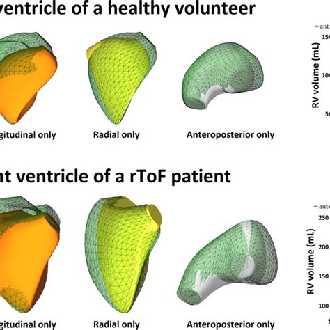 The Motion Of The Right Ventricular Wall During The Cardiac Cycle In